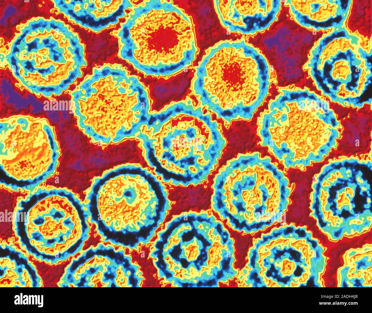 Epstein-Barr viruses, EBV. Coloured Transmission Electron Micrograph ...
