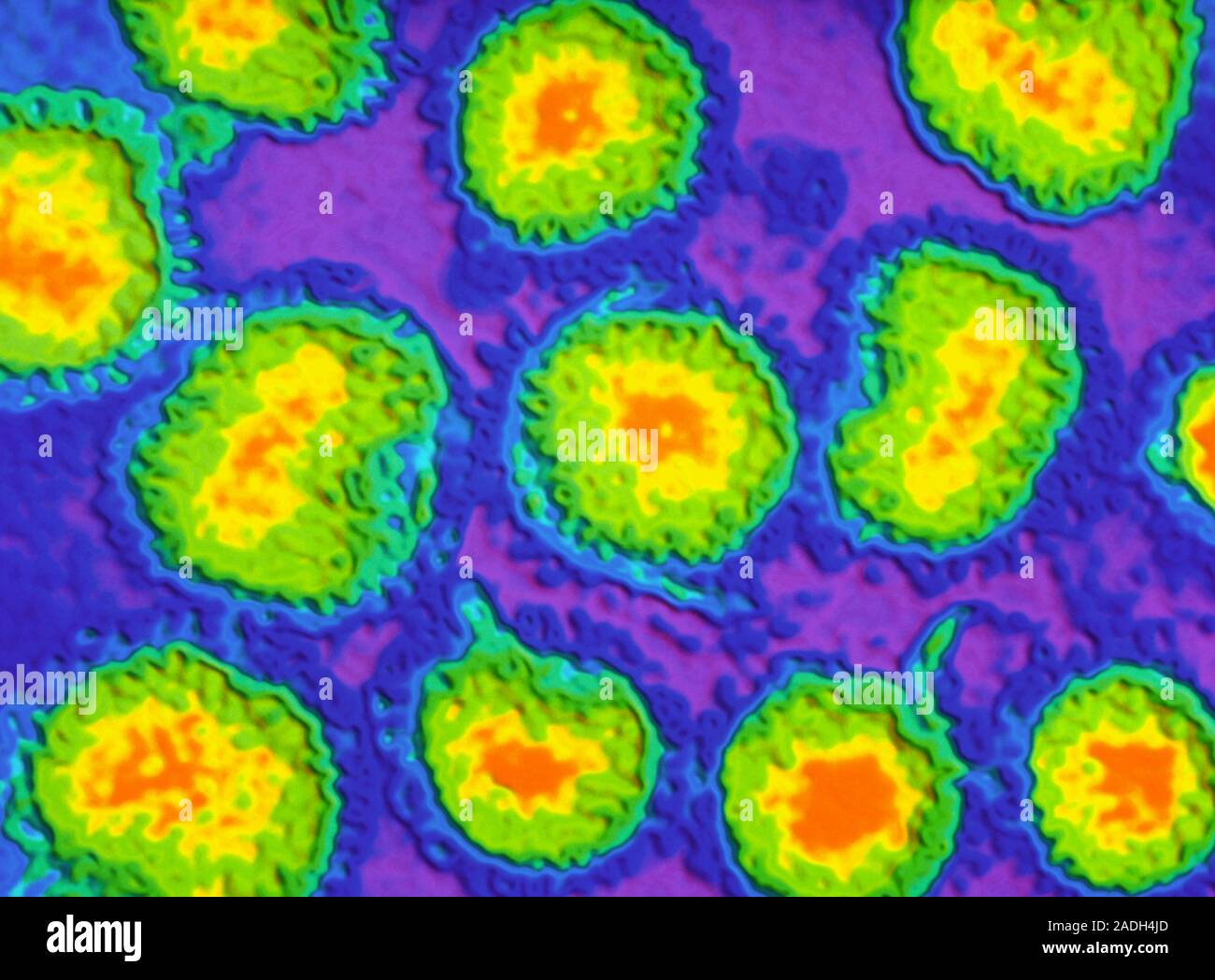 Bunyavirus. Coloured Transmission Electron Micro- graph (TEM) of a ...