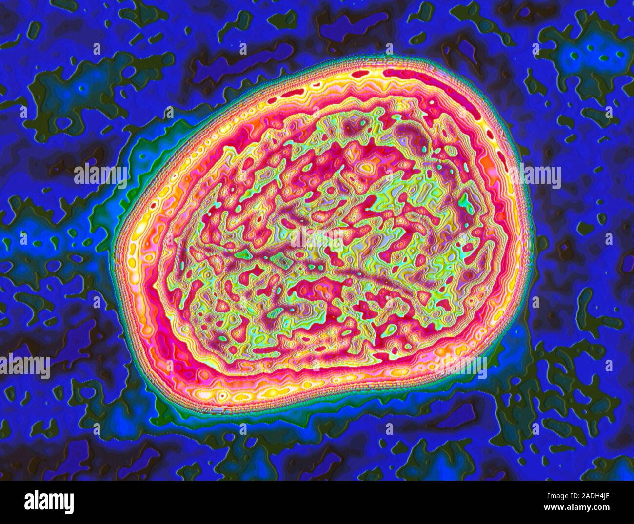 Mumps Virus Structure