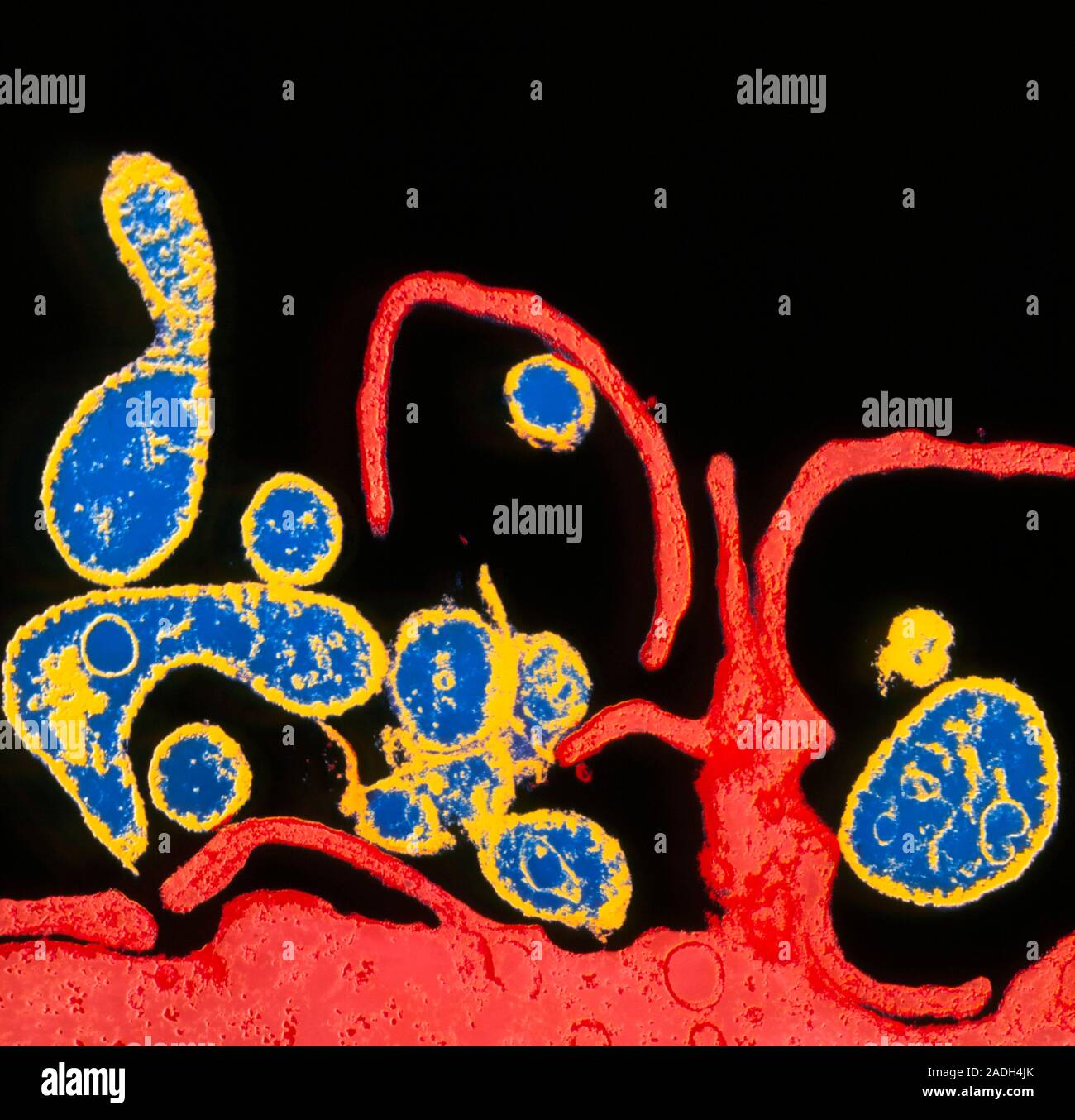Measles virus. Transmission electron micrograph (TEM) of measles ...