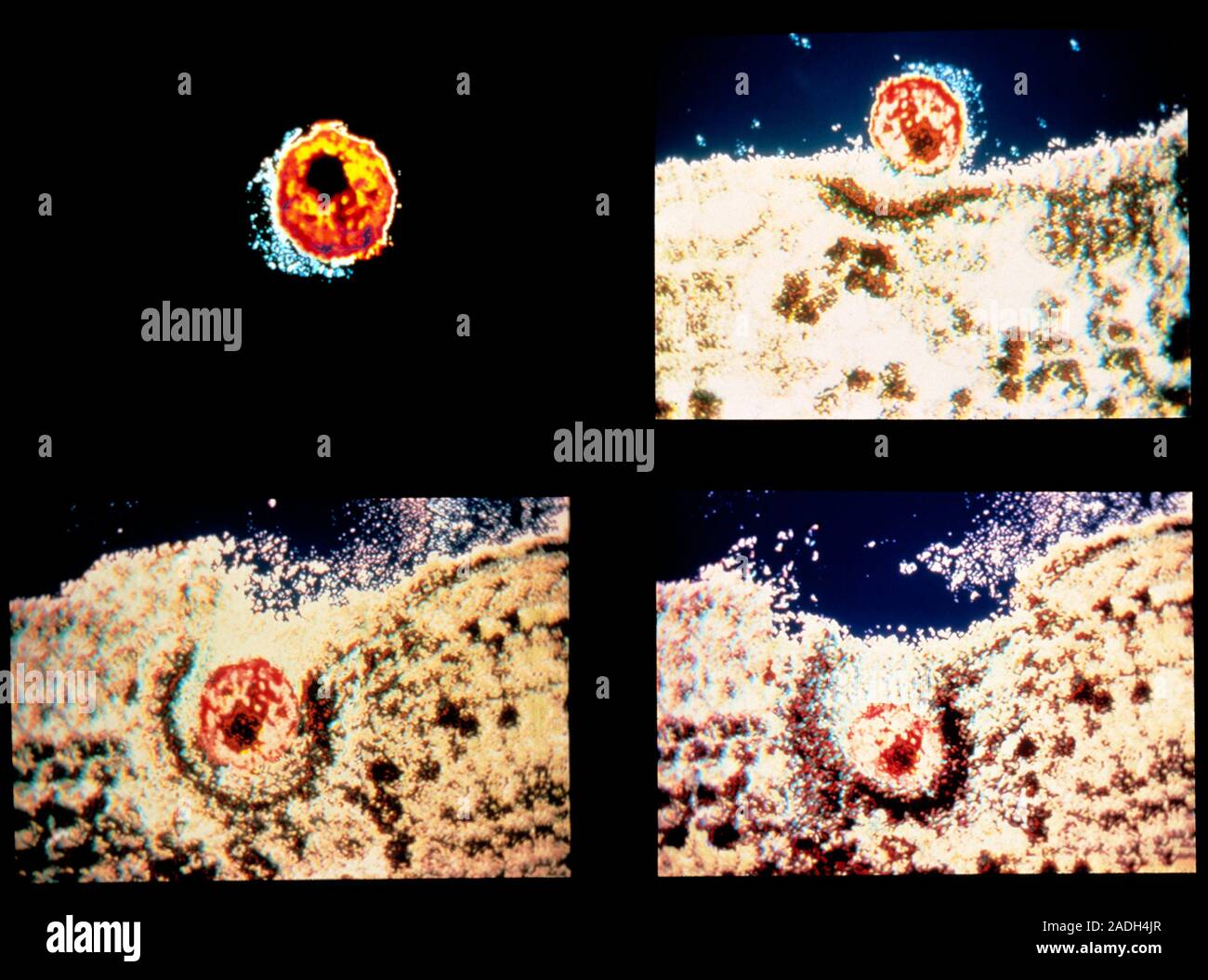 HIV virus infecting a cell. Coloured Transmission Electron Micrograph ...