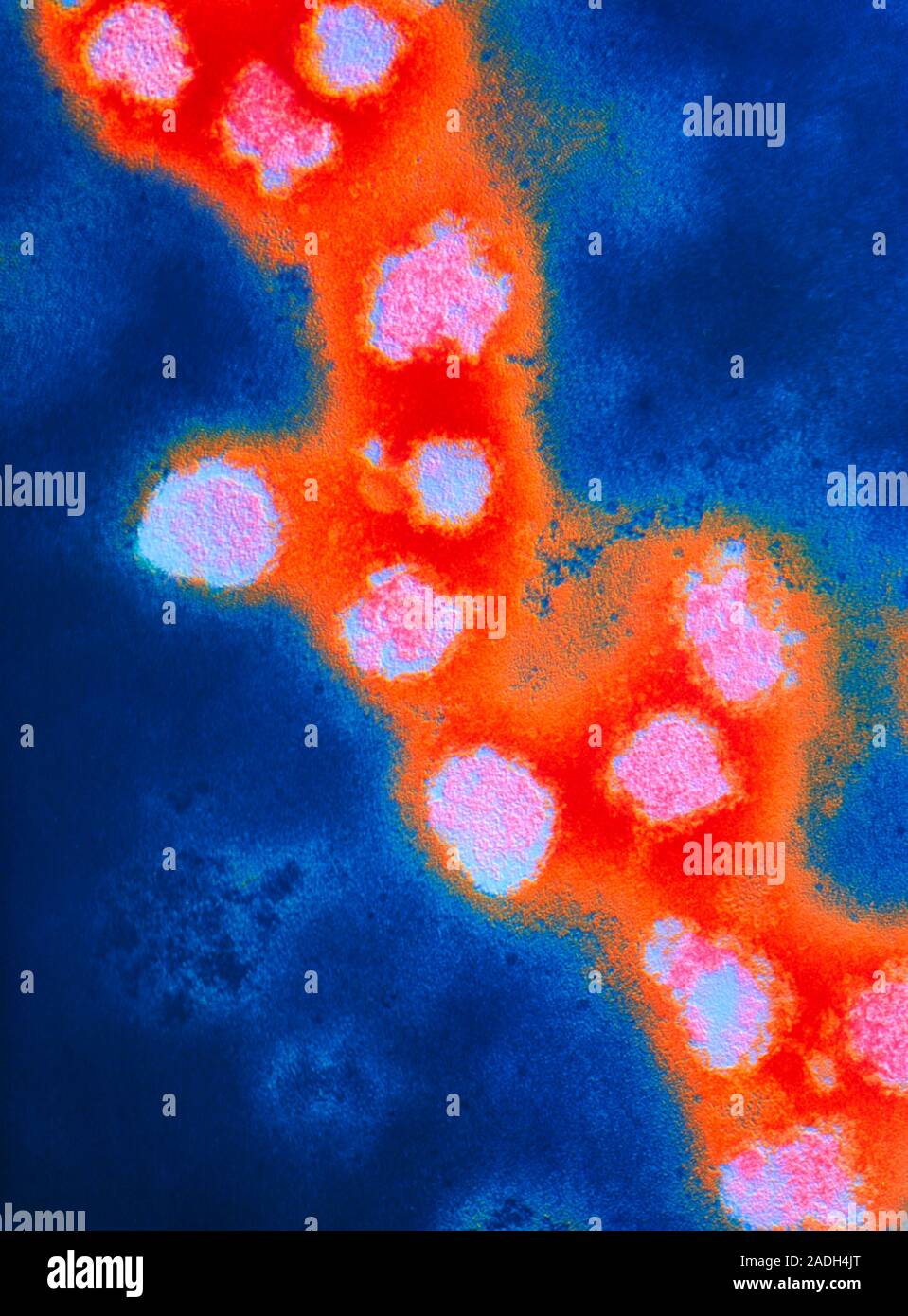 Rubella viruses. Coloured transmission electron micrograph of rubella ...
