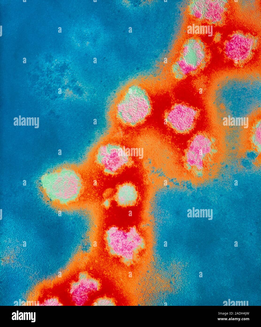 Rubella viruses. Coloured transmission electron micrograph of rubella ...