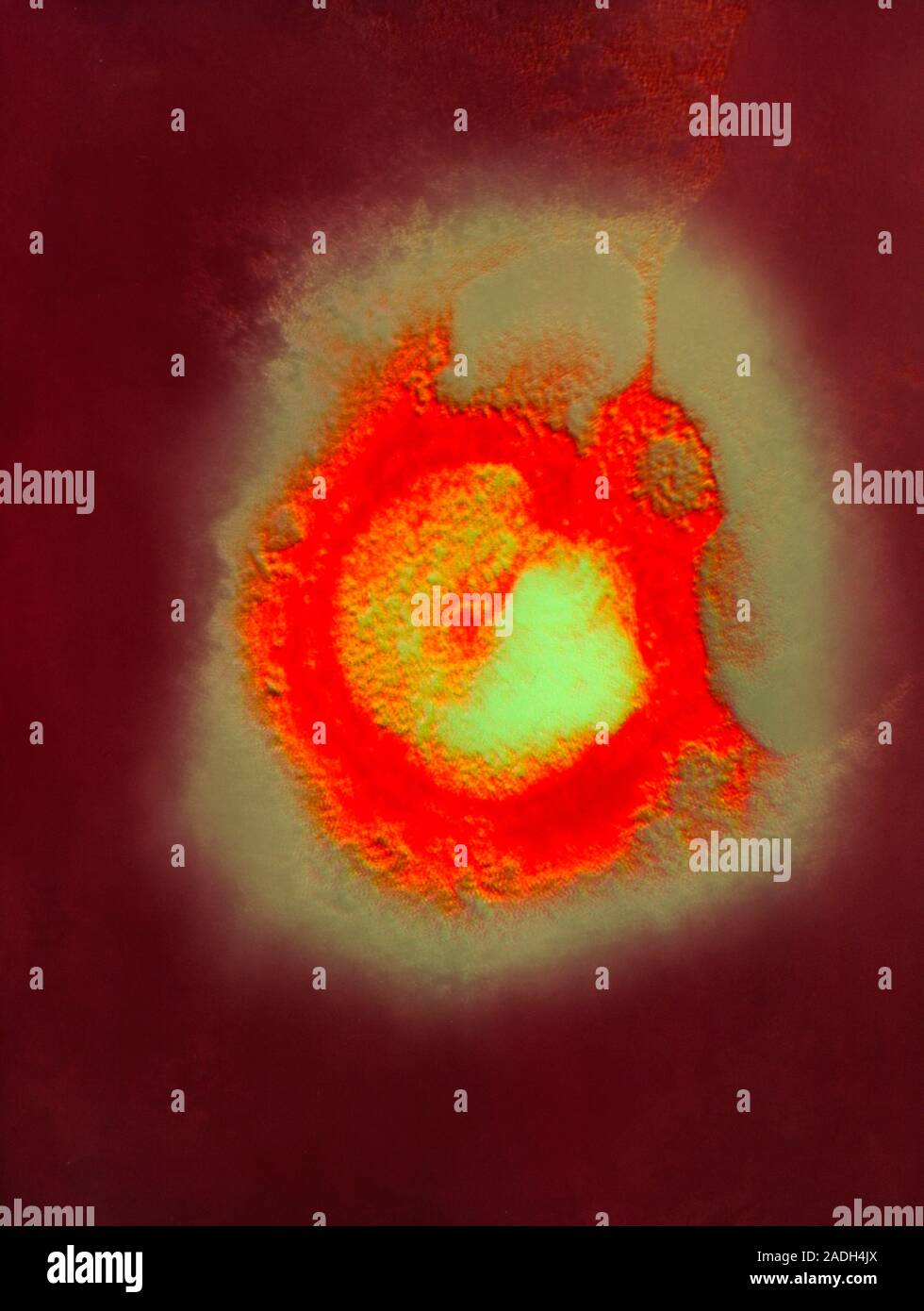 Mumps. Coloured transmission electron micrograph of a virus particles ...