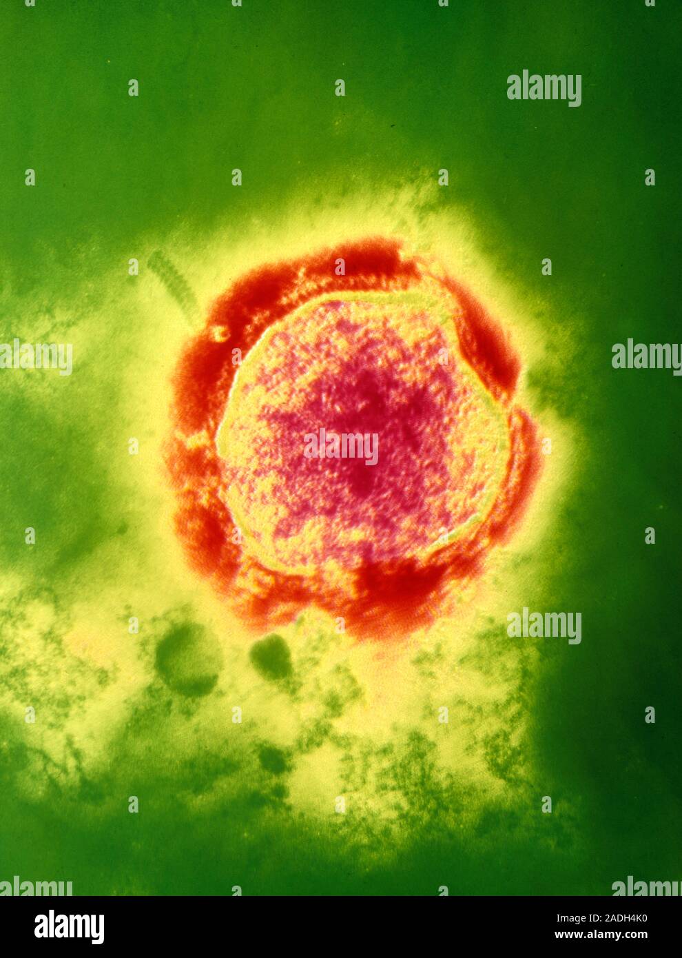 Measles virus. Coloured transmission electron micrograph (negative ... Measles virus. Coloured transmission electron micrograph (negative ...