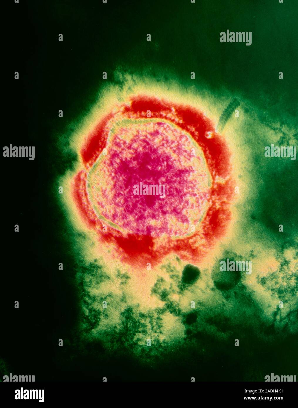 Measles virus. Coloured transmission electron micrograph (negative ...