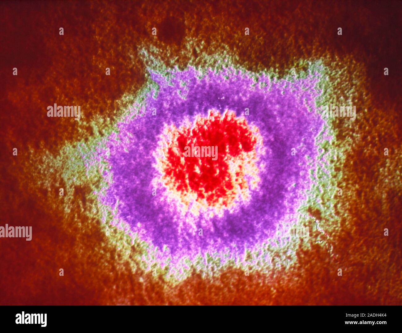 Herpes simplex virus. Coloured transmission electron micrograph of a ...