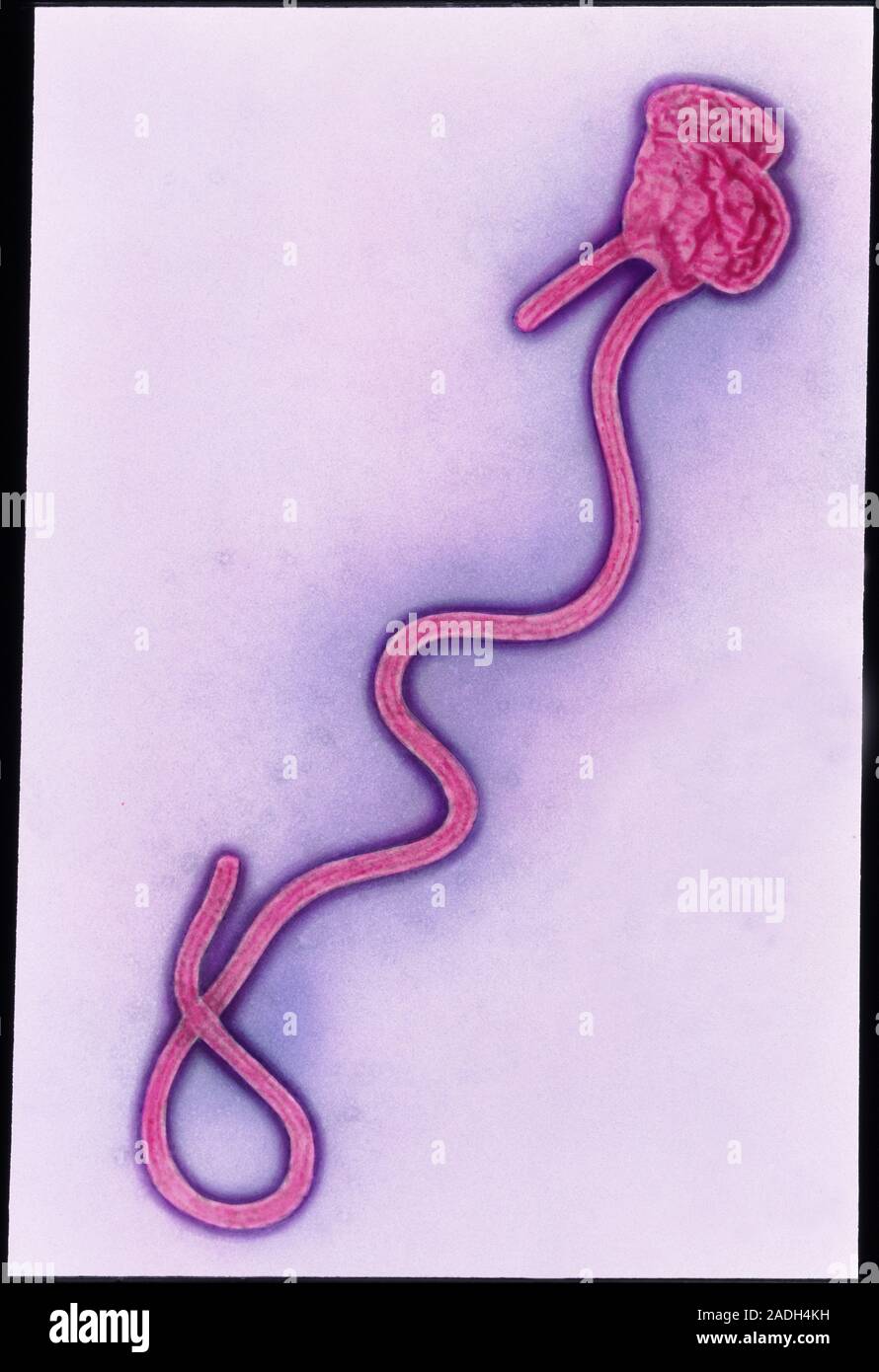 Ebola virus. Coloured transmission electron micrograph of a single ...