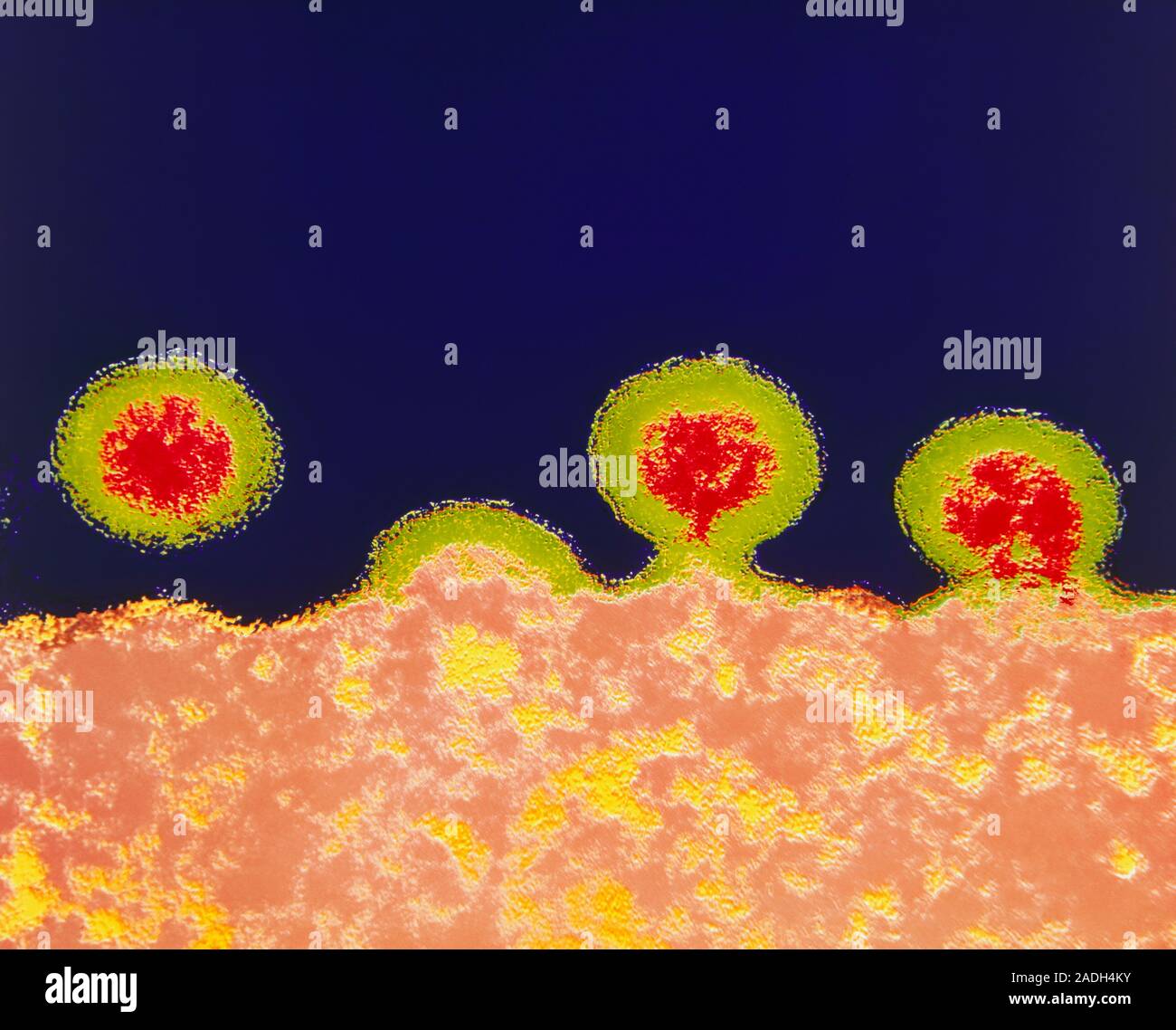 HIV viruses budding from T-cell. Coloured Trans- mission Electron ...