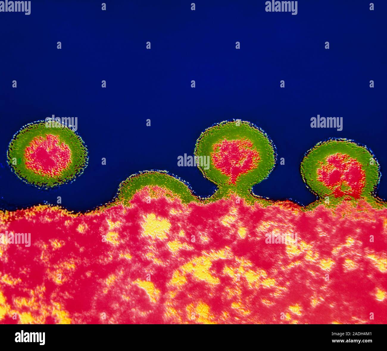 HIV viruses budding from T-cell. Coloured Trans- mission Electron ...