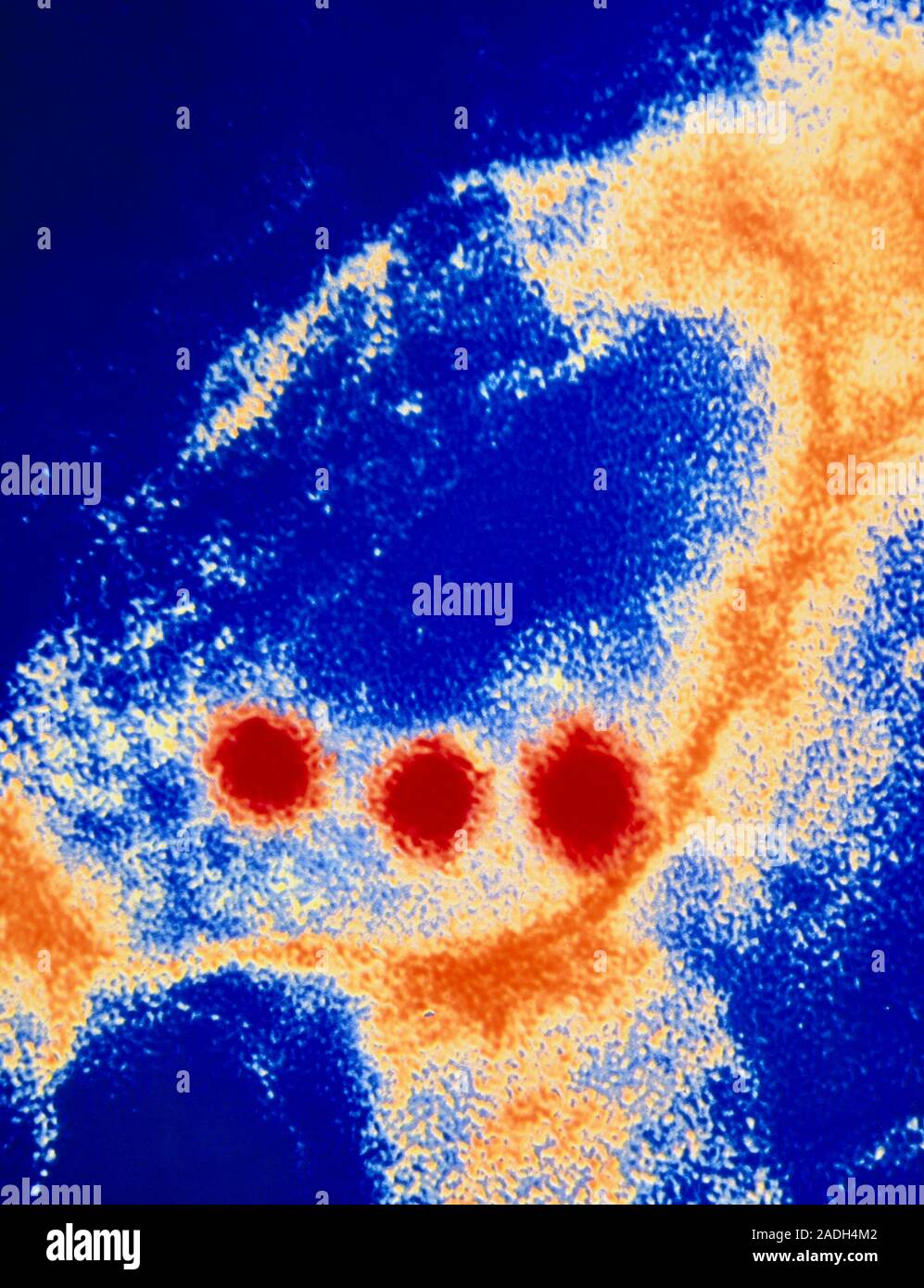 Dengue virus. Coloured transmission electron micrograph of dengue virus ...