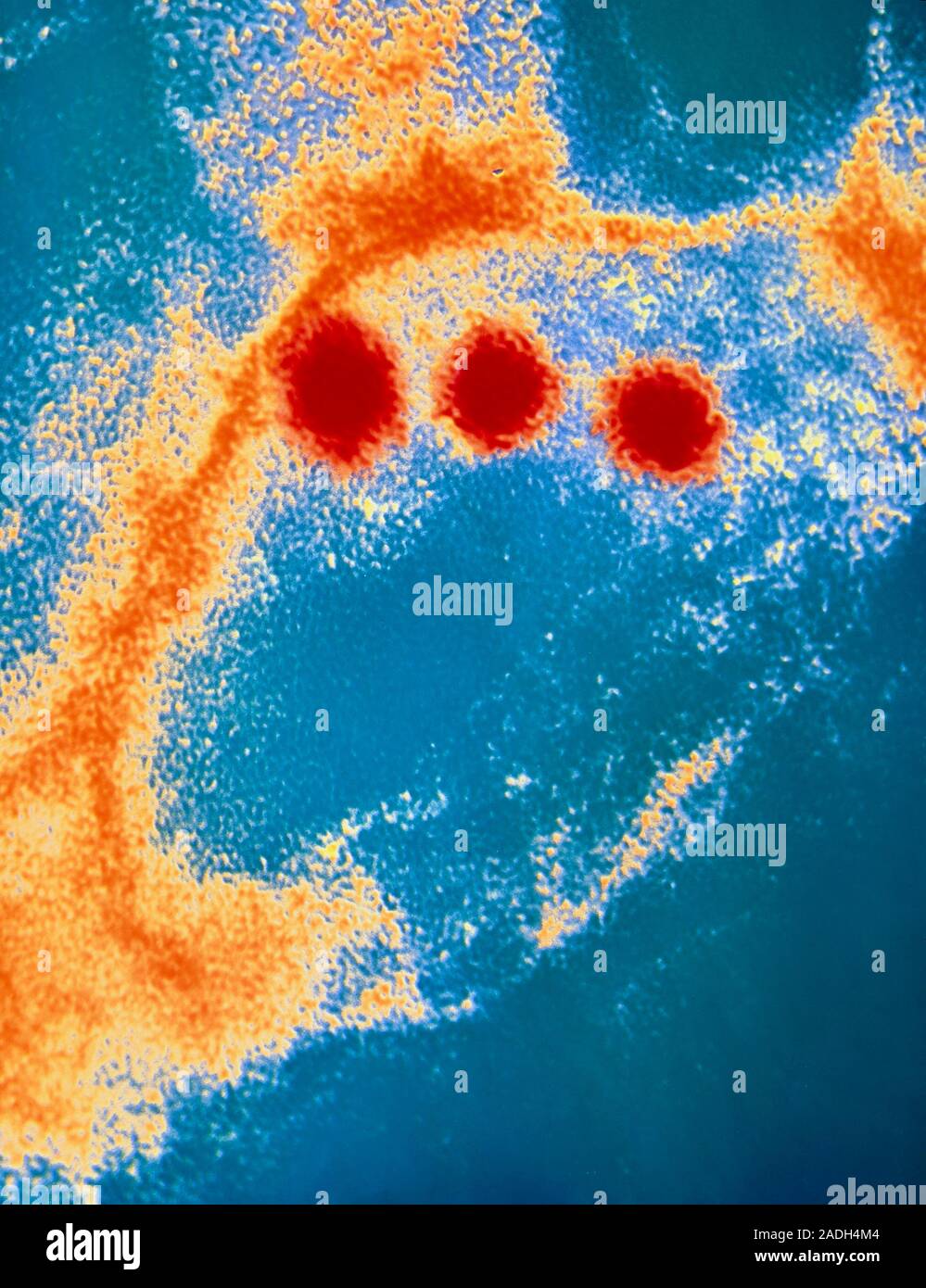Dengue virus. Coloured transmission electron micrograph of dengue virus ...