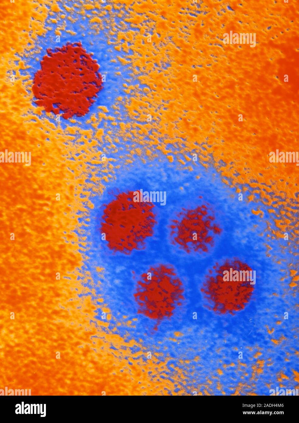 Dengue virus. Coloured transmission electron micrograph of negatively ...