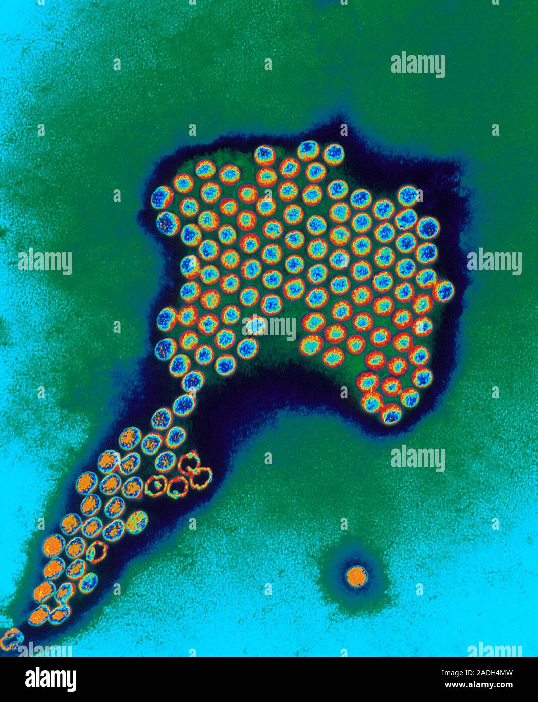 Polio viruses. Coloured Transmission Electron Micrograph (TEM) of polio ...
