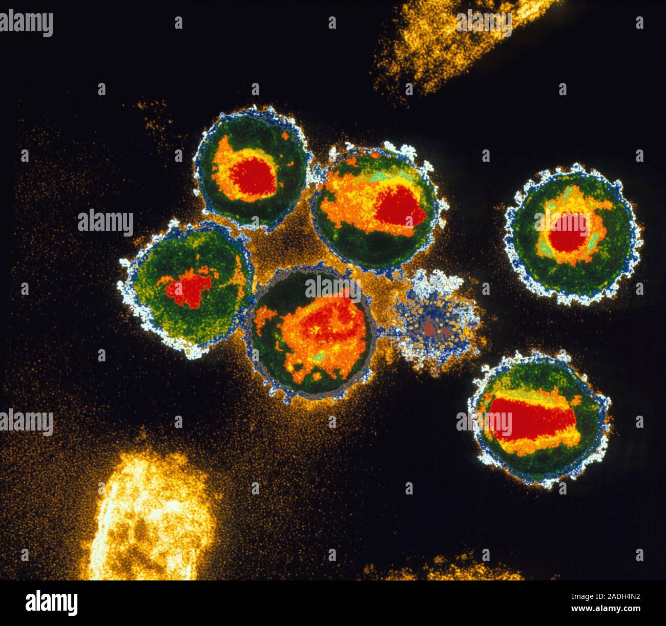 HIV viruses. Coloured Transmission Electron Micrograph (TEM) of a ...