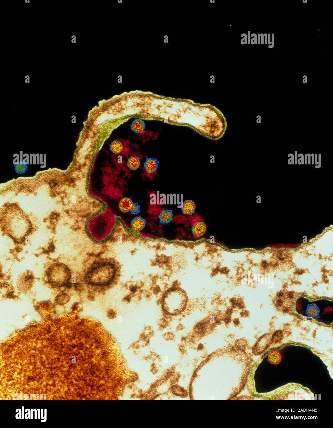 Yellow fever virus. Coloured Transmission Electron Micrograph (TEM) of ...