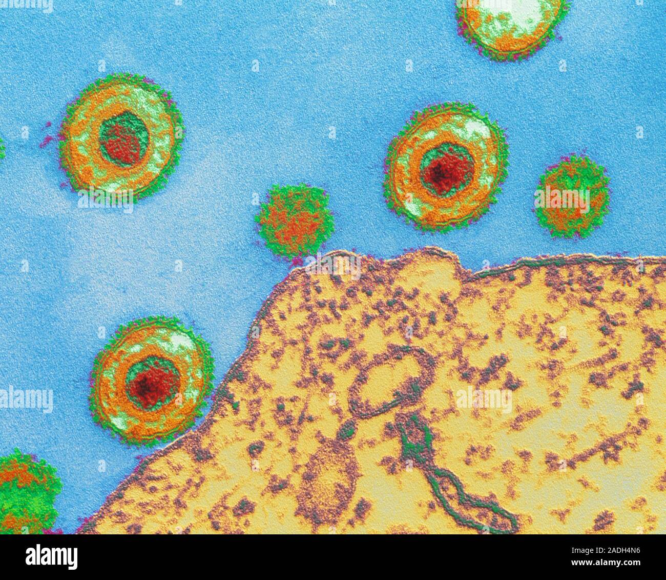 Varicella-zoster viruses. Coloured Transmission Electron Micrograph ...