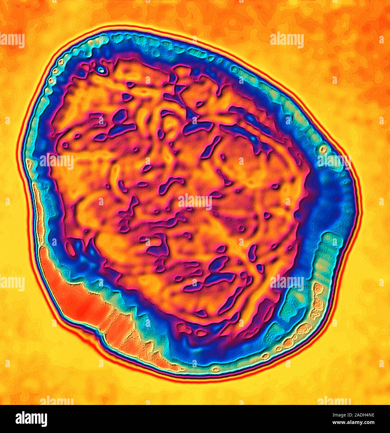 Measles virus. Coloured Transmission Electron Micrograph (TEM) of a ...