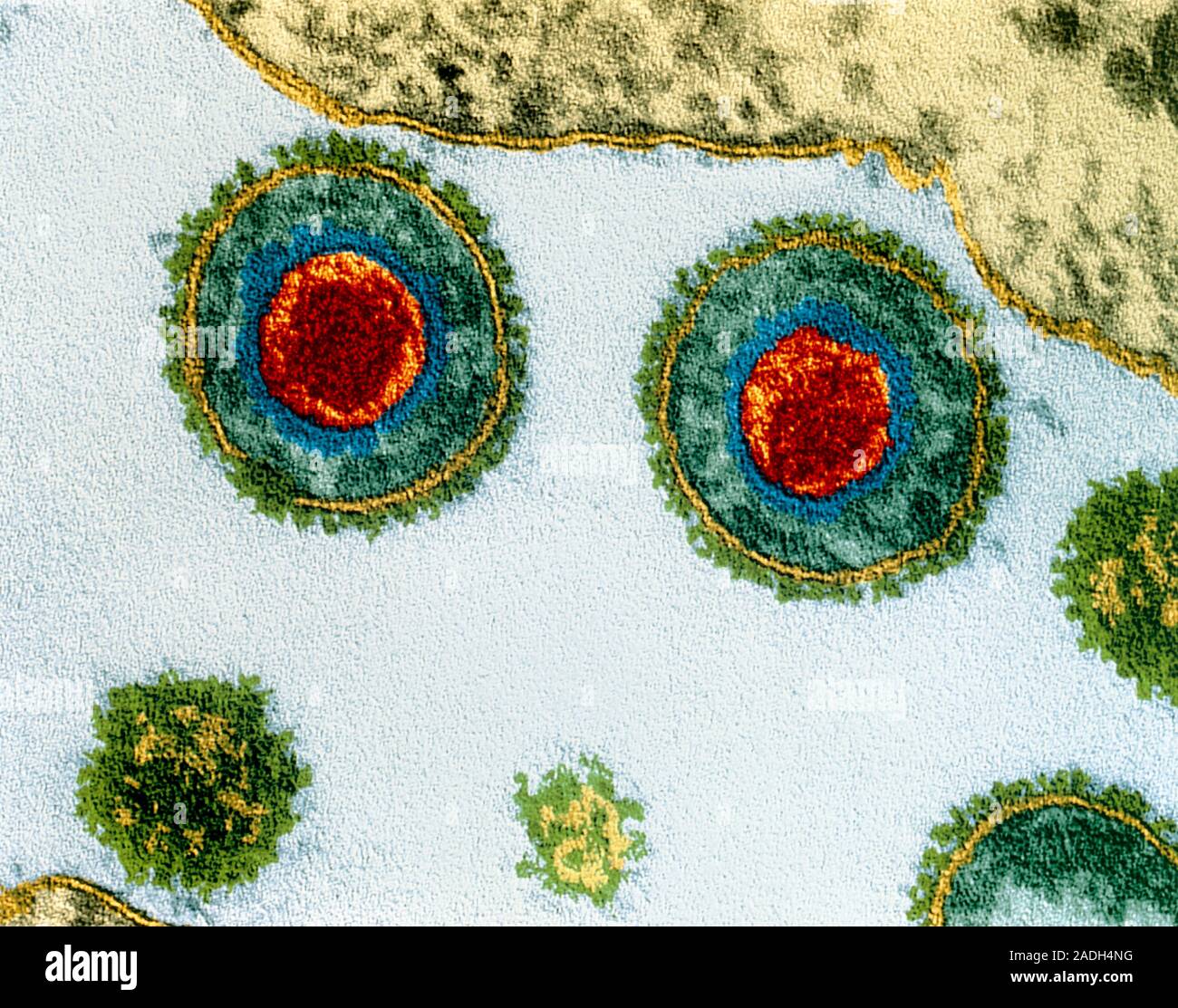 Herpes simplex viruses. Coloured Transmission Electron Micrograph (TEM ... Herpes simplex viruses. Coloured Transmission Electron Micrograph (TEM ...