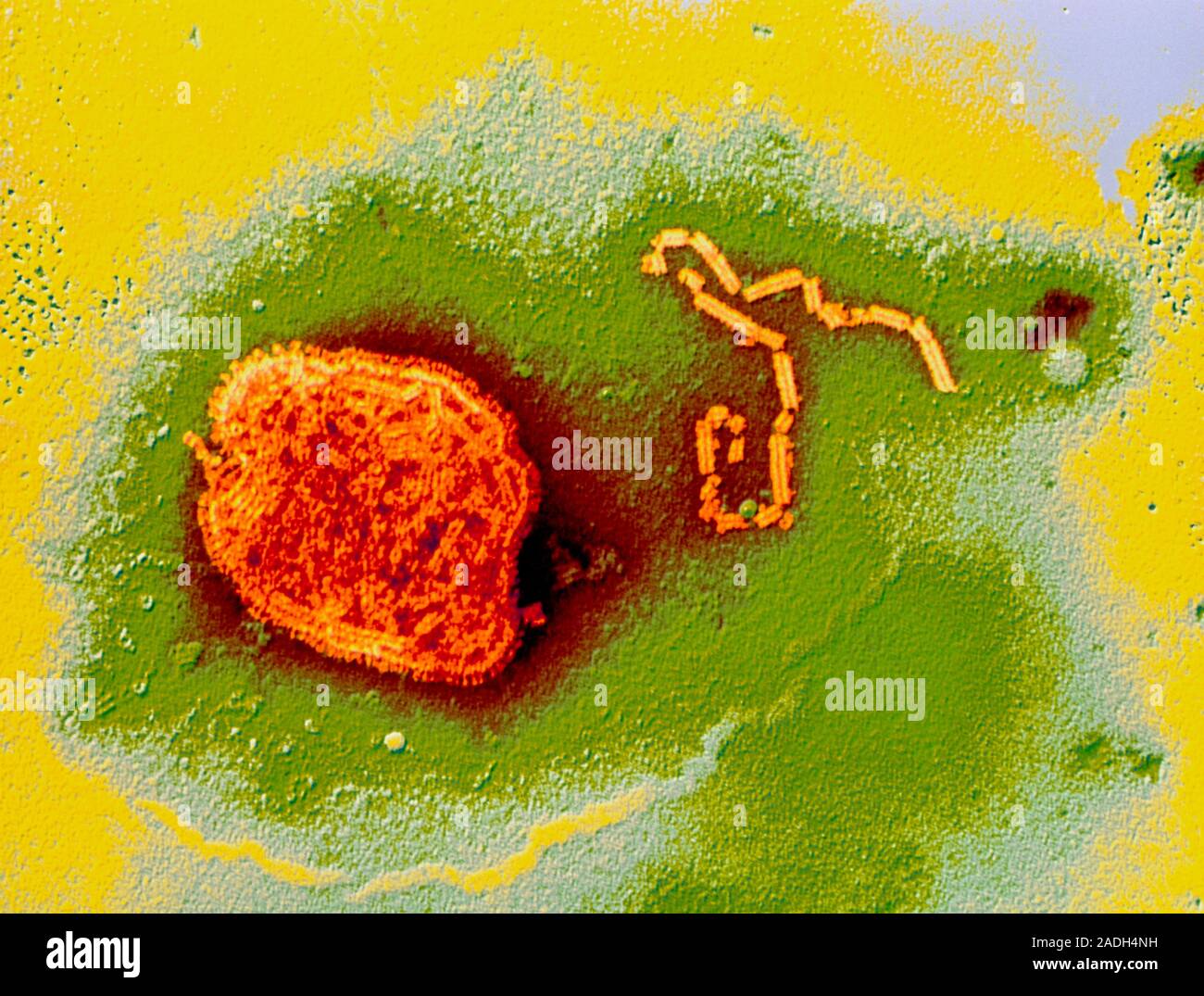 Mumps virus. Coloured Transmission Electron Micro- graph (TEM) of a ...