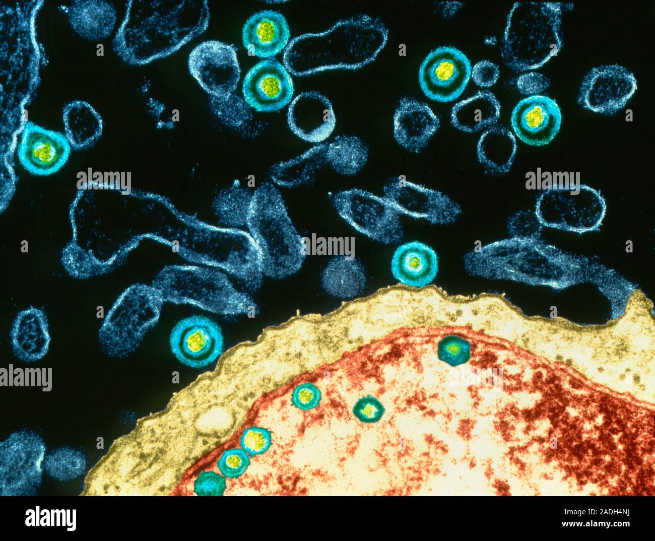 Herpes viruses. Coloured Transmission Electron Micrograph (TEM) of ...