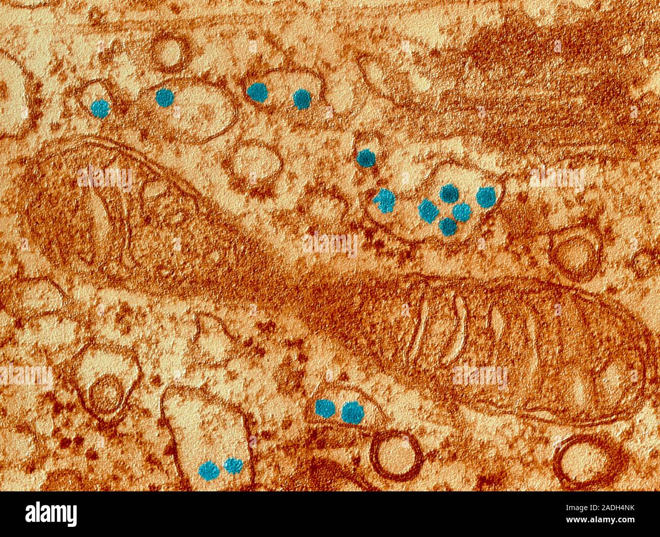 Rubella viruses. Coloured Transmission Electron Micrograph (TEM) of a ...