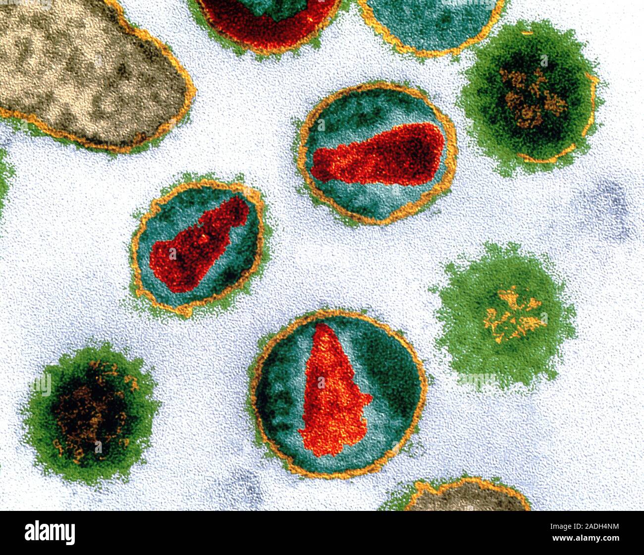 HIV viruses. Coloured Transmission Electron Micro- graph (TEM) of several Human Immunodeficiency ...