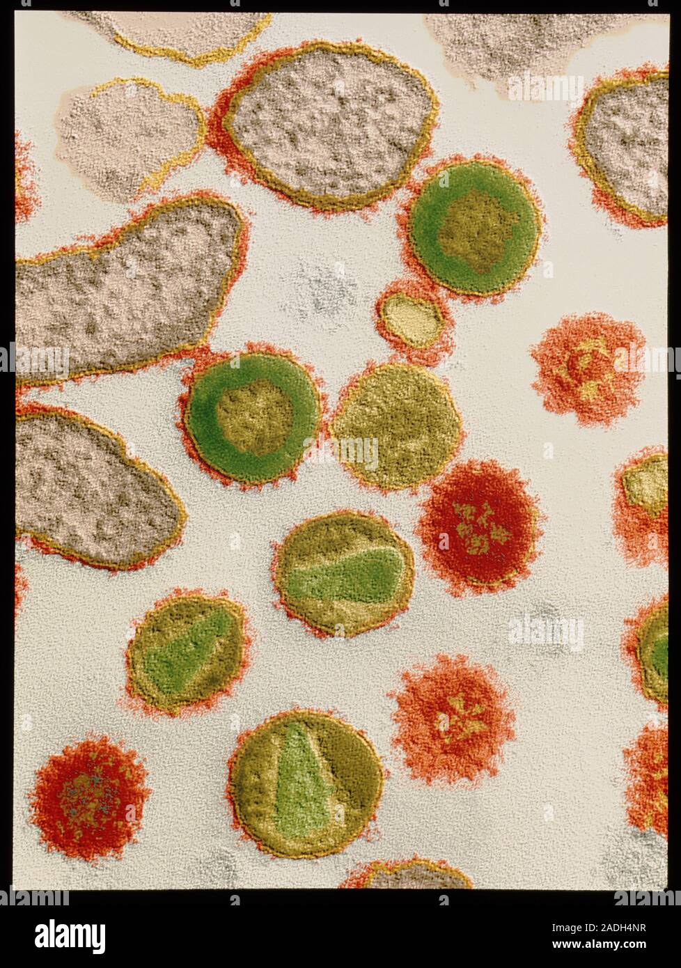 HIV viruses. Coloured Transmission Electron Micrograph (TEM) inside a ...