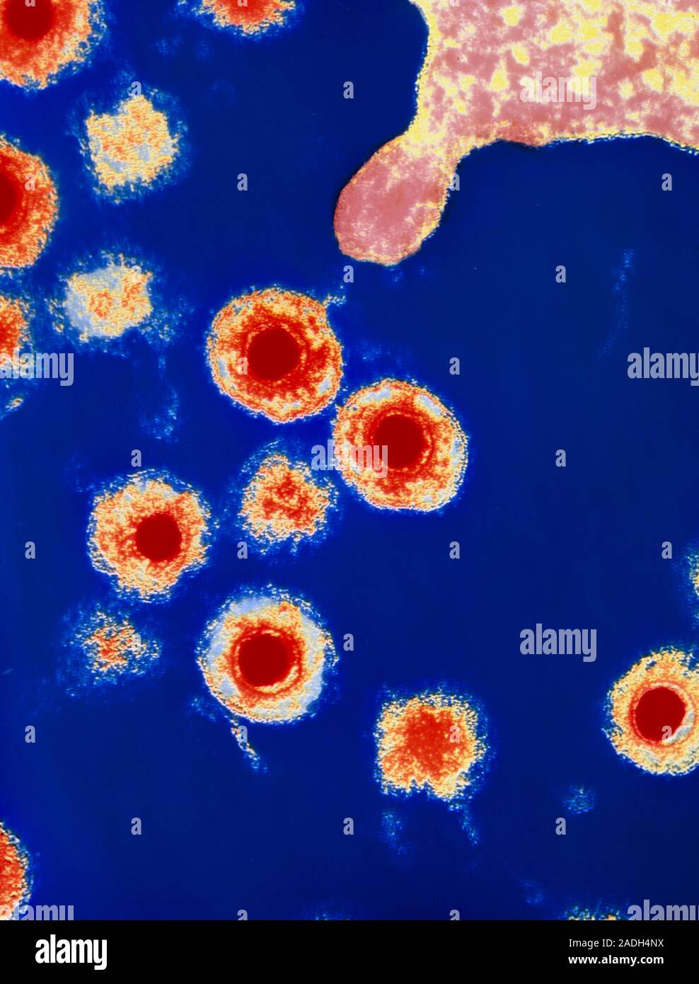 Human Herpes Virus type 6. Coloured Transmission Electron Micrograph of ...