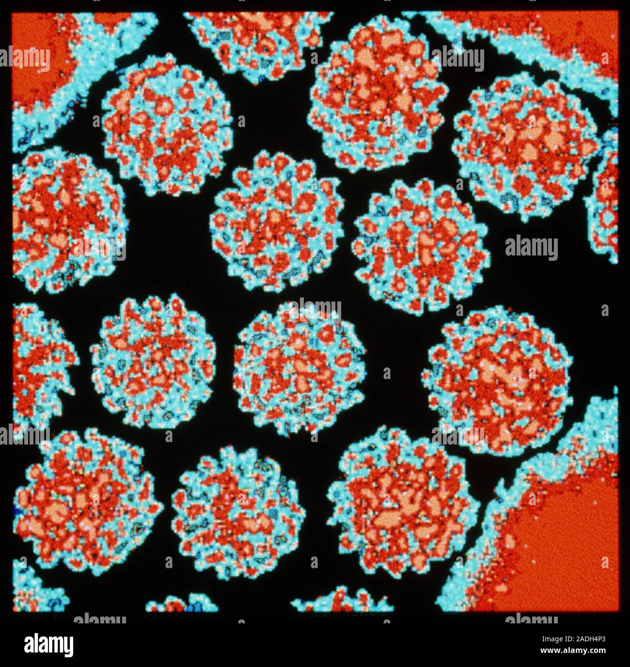 Wart virus. Coloured Transmission Electron microg- raph of Papilloma ...
