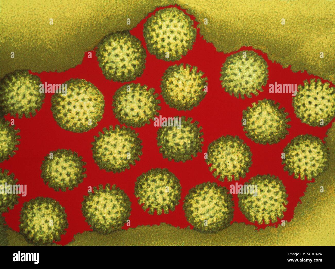 Rotaviruses. Coloured Transmission Electron Micro- graph (TEM) of a ...