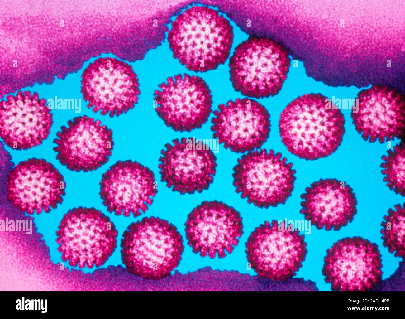 Rotaviruses. Coloured Transmission Electron Micro- graph (TEM) of a ...