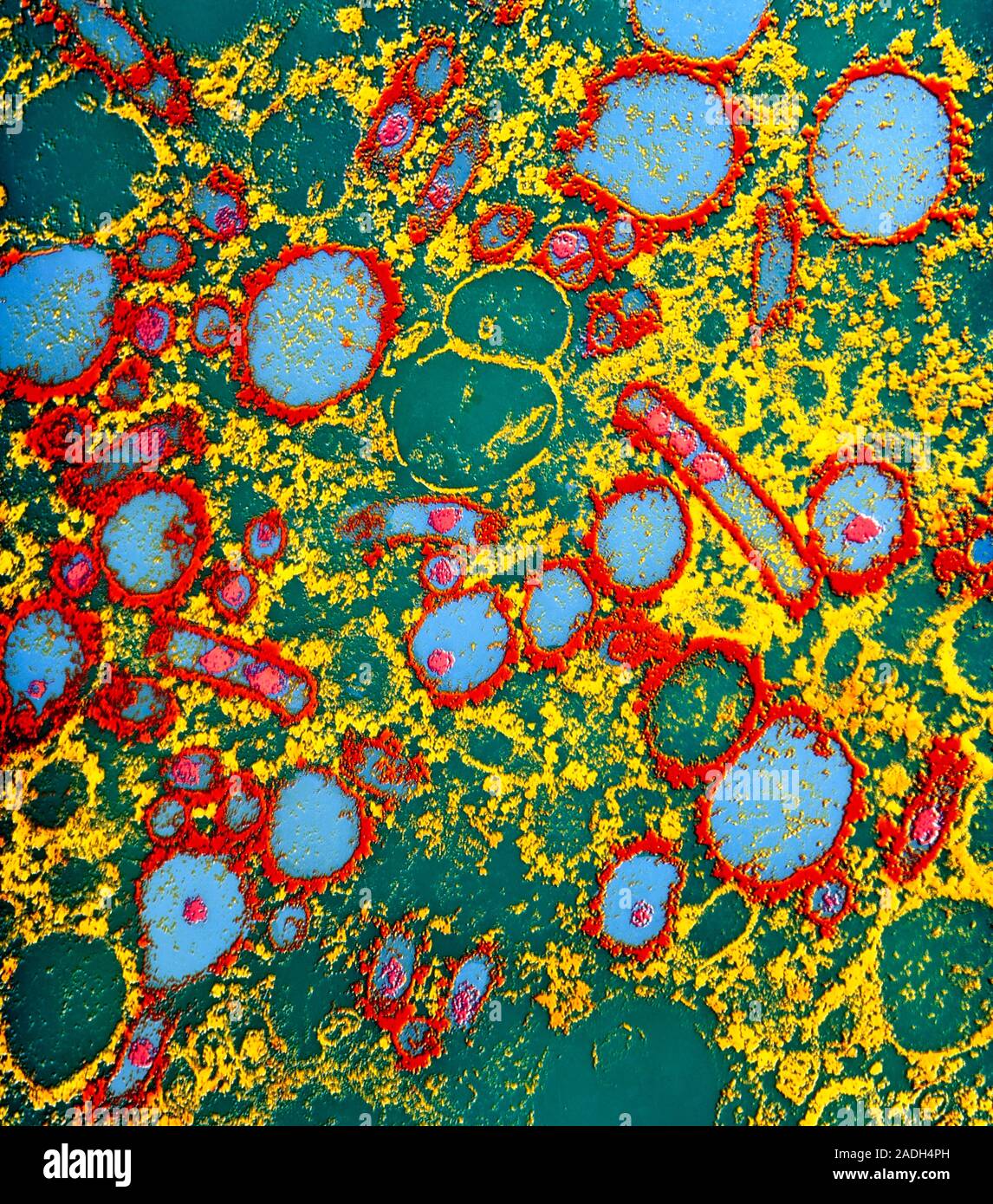 Bovine viral diarrhoea virus (BVDV). Coloured transmission electron ...