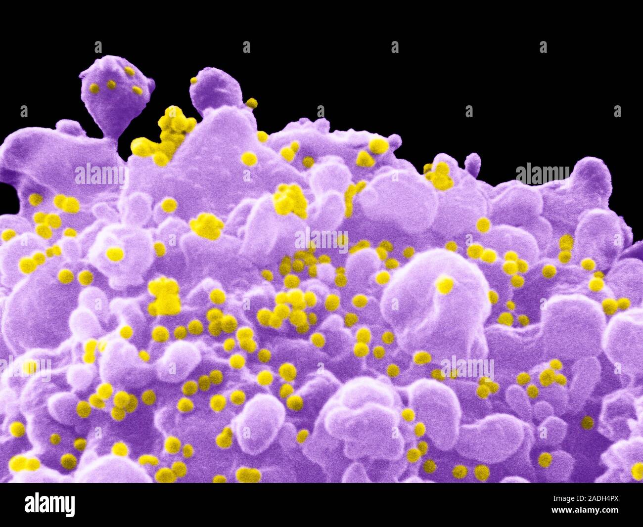 AIDS virus. Coloured scanning electron micrograph (SEM) of the surface ...