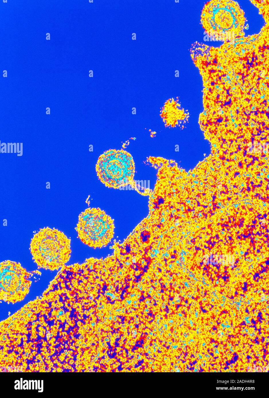 HHV type 6. Coloured transmission electron micrograph of Human Herpes ...