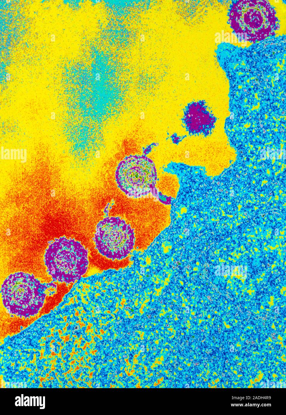HHV type 6. Coloured transmission electron micrograph of Human Herpes ...