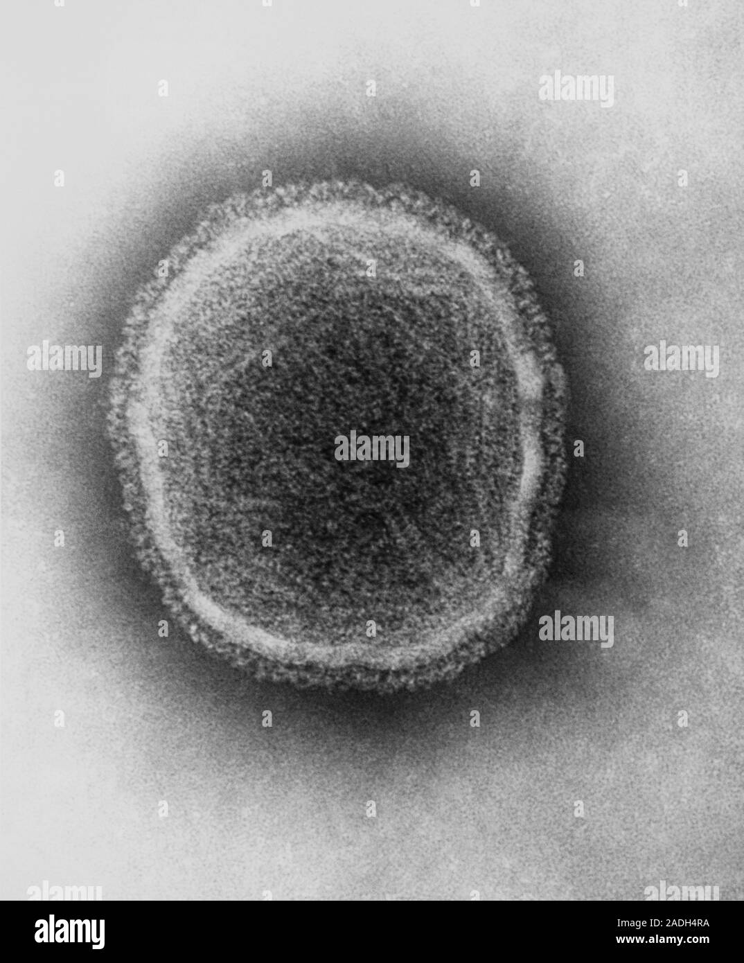 Parainfluenza virus. Transmission electron micrograph of a section ...