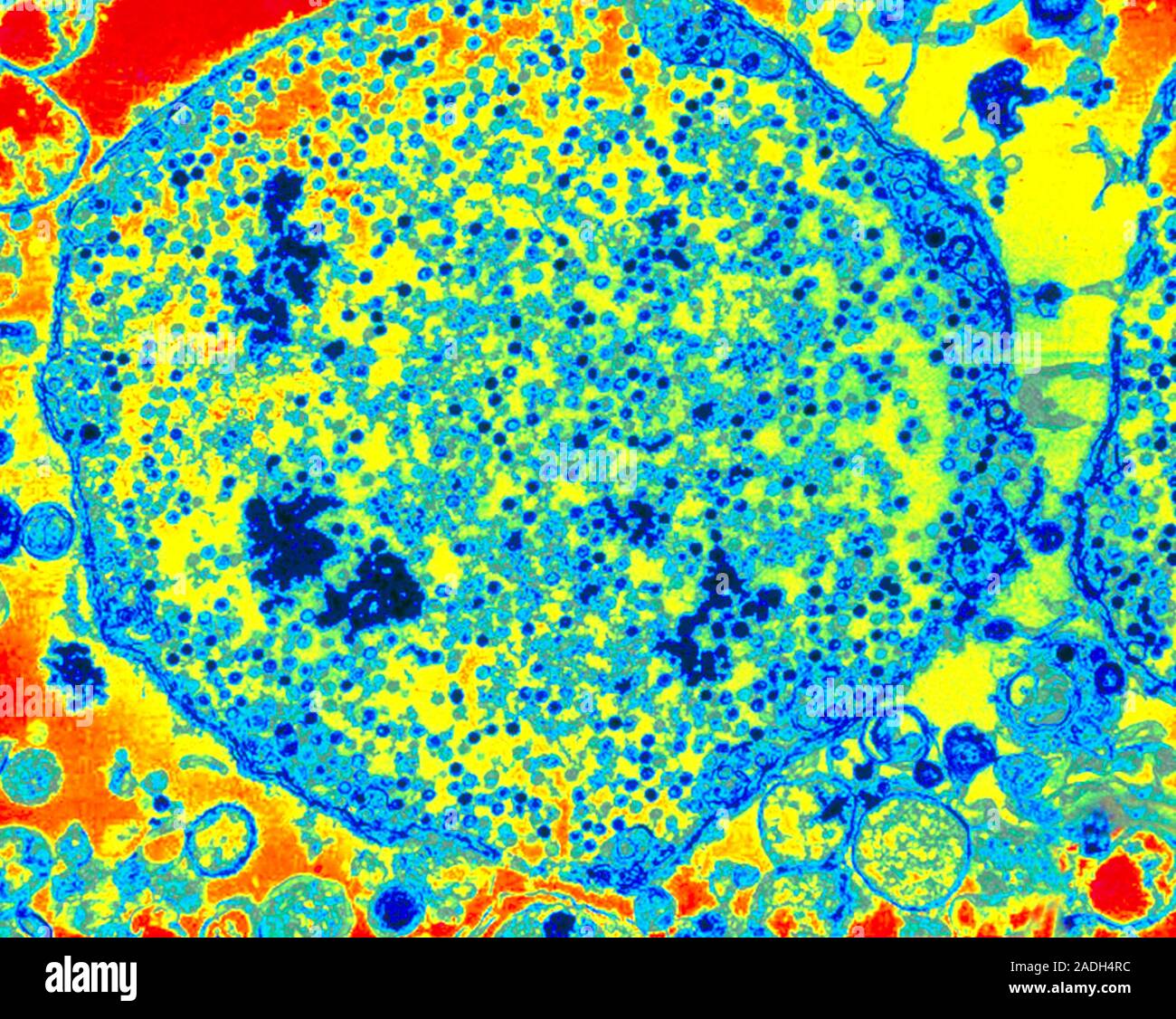 Herpes Simplex I Viruses Coloured Transmision Electron Micrograph Tem Of A Section Through A