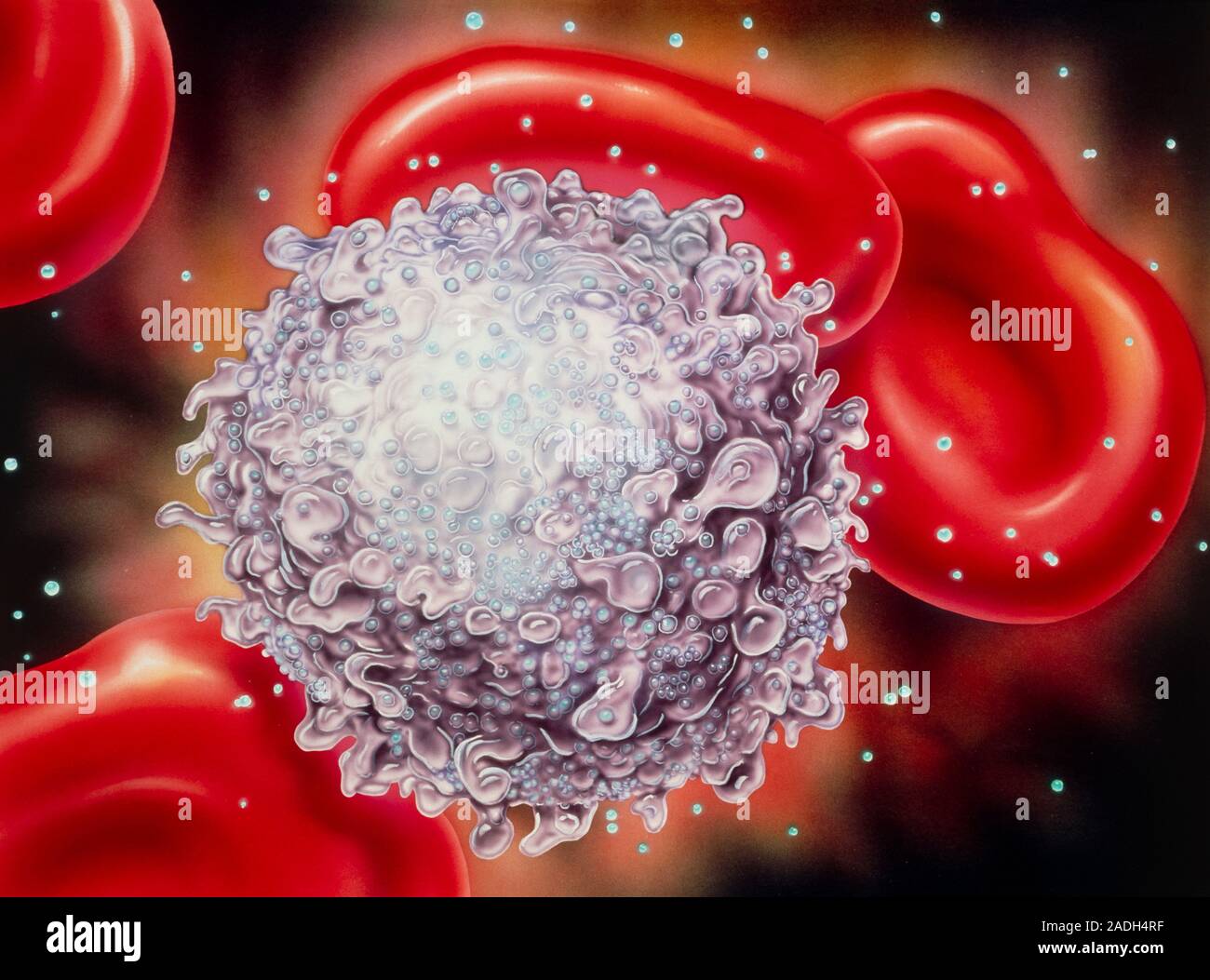 AIDS virus. Illustration of a T-lymphocyte white blood cell (mauve ...