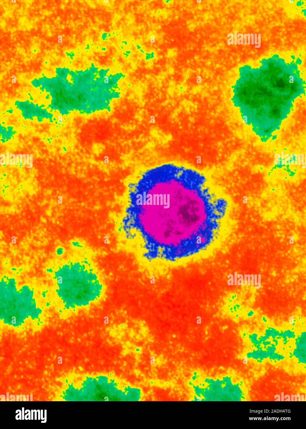 Borna virus. Coloured Transmission Electron Micro- graph of a Borna ...