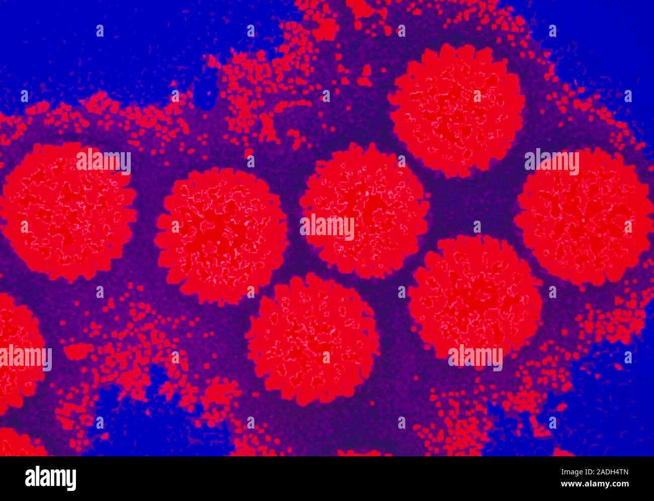 Rotaviruses. Coloured transmission electron micrograph (TEM) of a ...