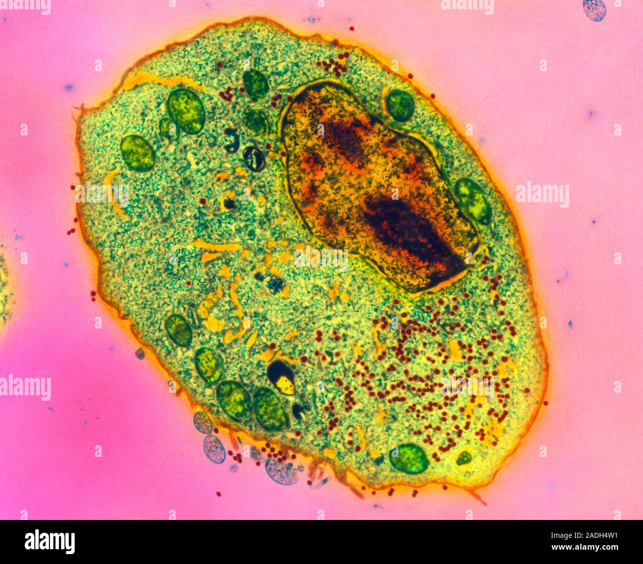 Retrovirus infection. Coloured transmission electron micrograph (TEM ...