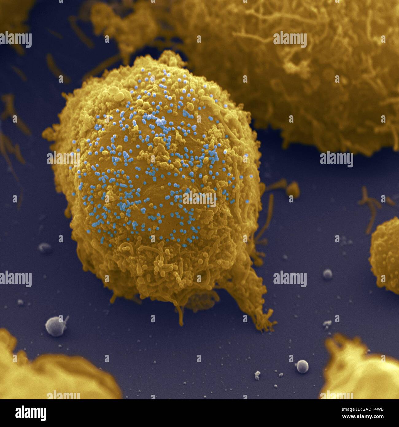 AIDS virus. Coloured scanning electron micrograph (SEM) of a T ...