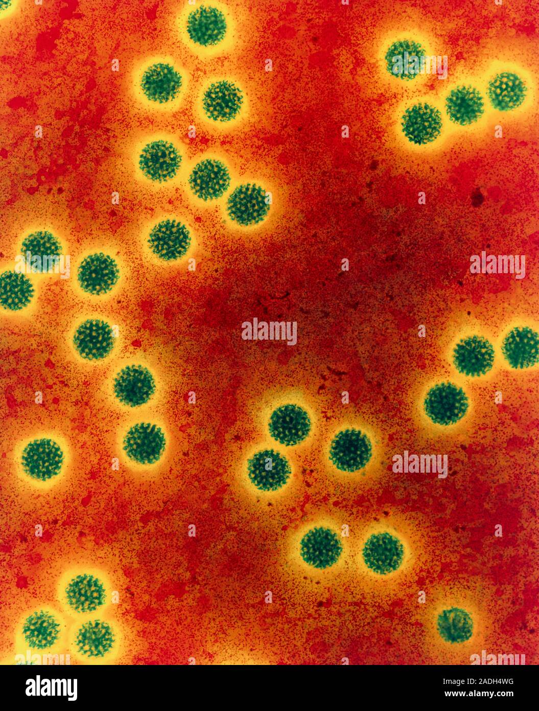 Rotaviruses. Coloured transmission electron micrograph (TEM) of ...