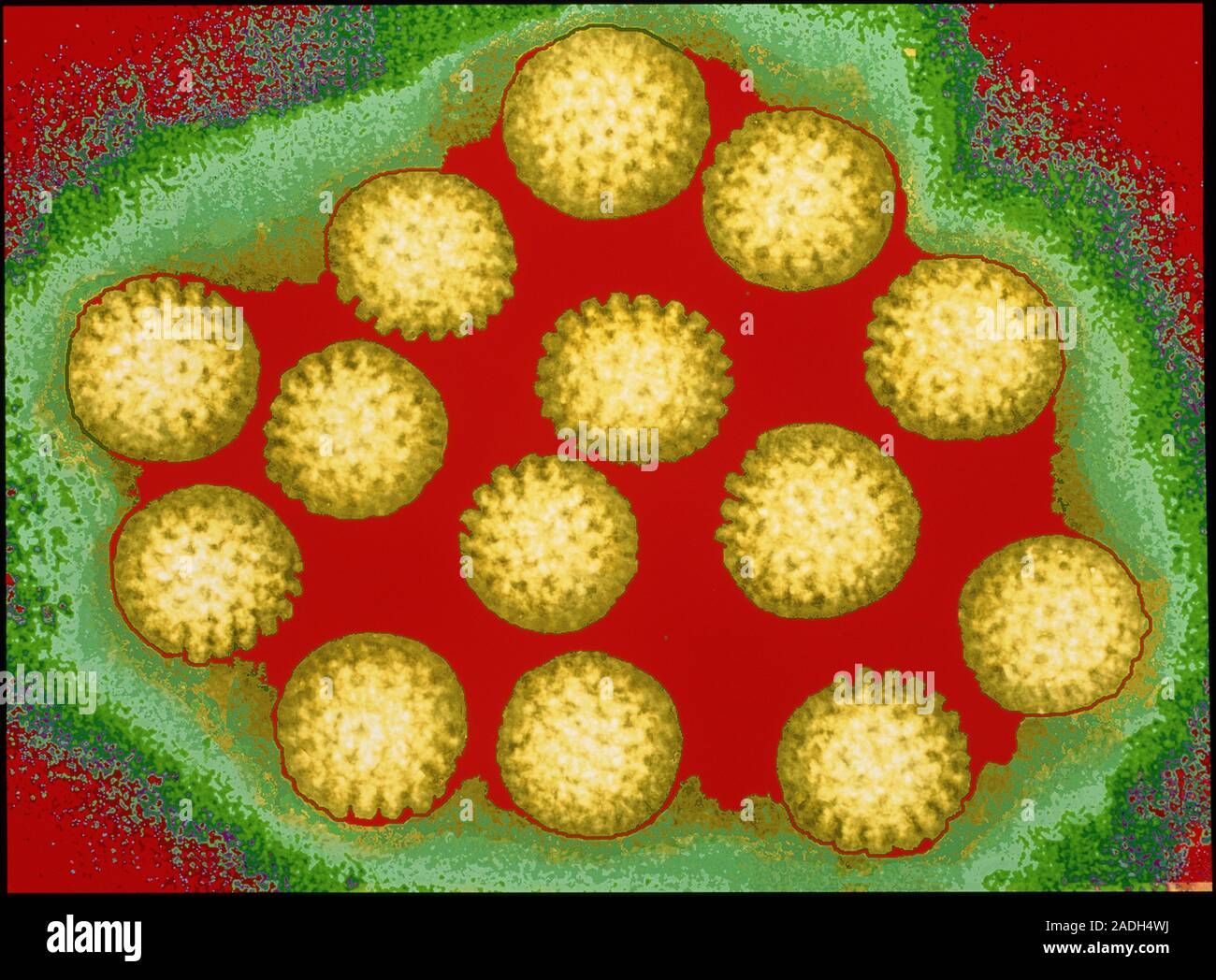 Rotaviruses. Coloured transmission electron micro- graph (TEM) of a ...