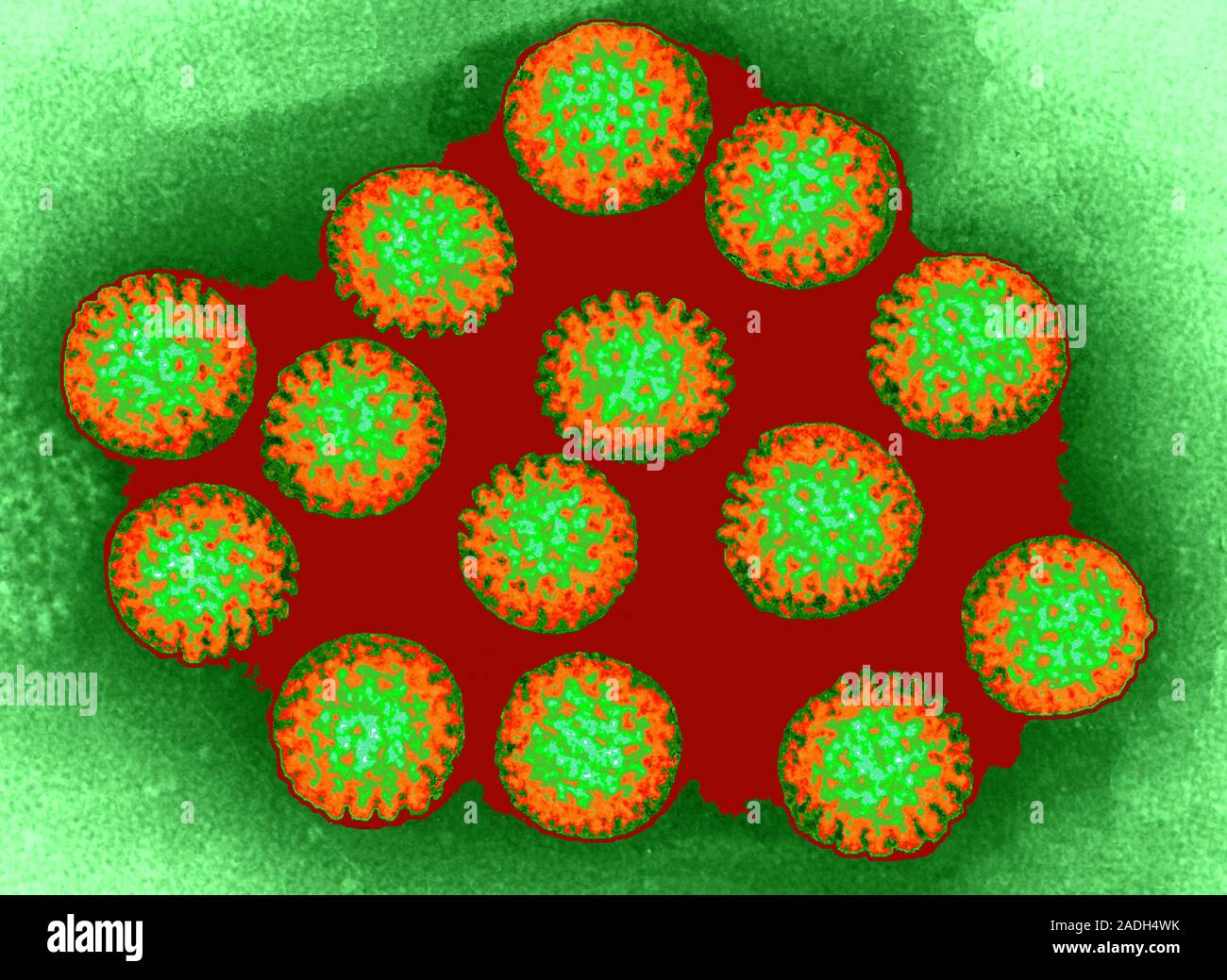 Rotaviruses. Coloured transmission electron micro- graph (TEM) of a ...