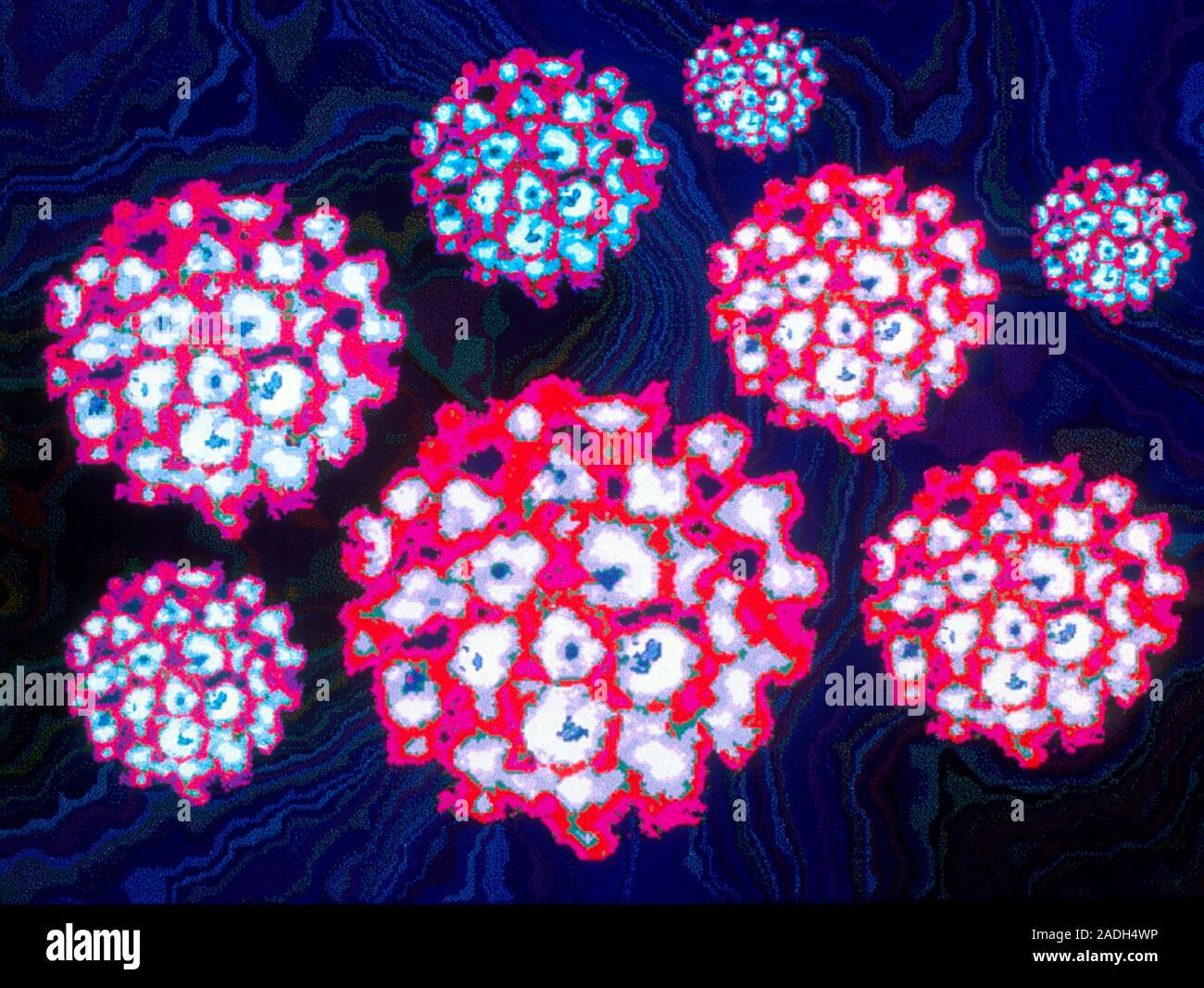 Wart viruses. Composite coloured transmission electron micrograph (TEM ...
