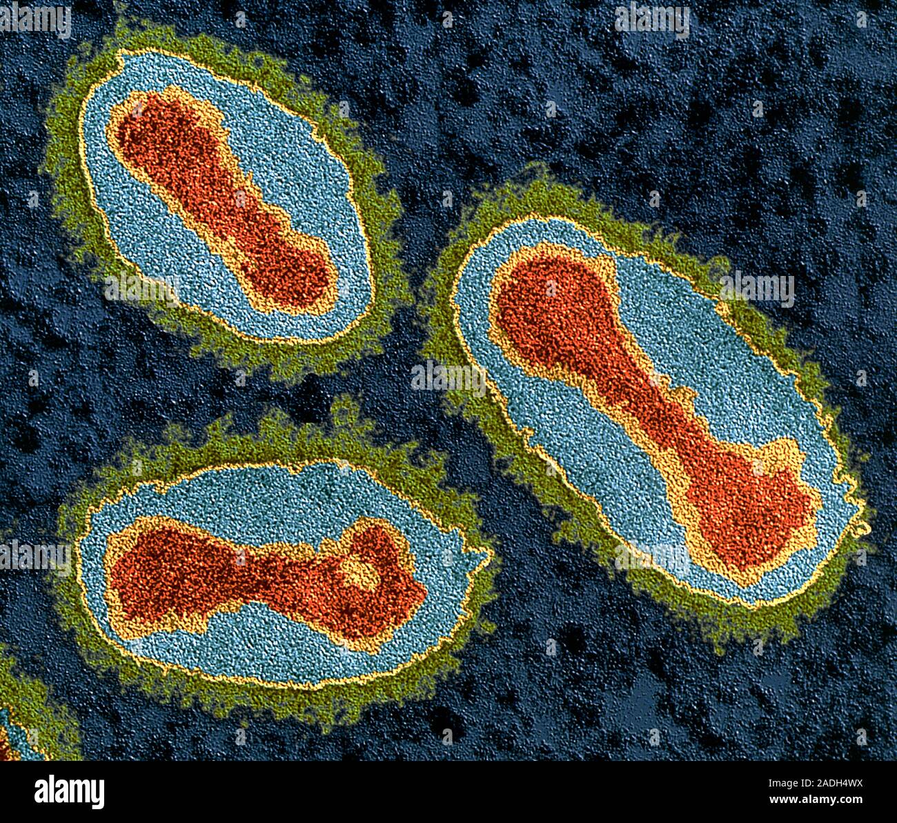 Smallpox viruses. Coloured transmission electron micrograph (TEM) of a ...