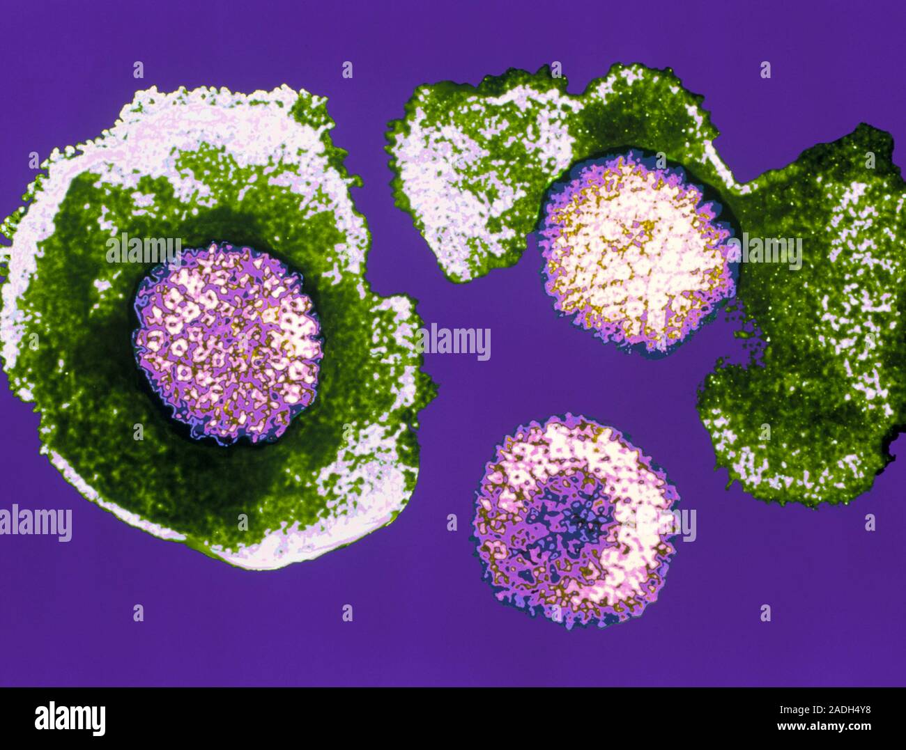 Herpes simplex viruses. Coloured transmission electron micrograph (TEM) of three herpes simplex ...