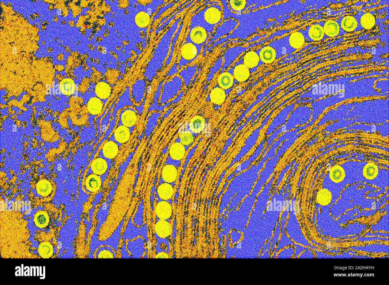 Herpes simplex viruses. Coloured transmission electron micrograph (TEM ...